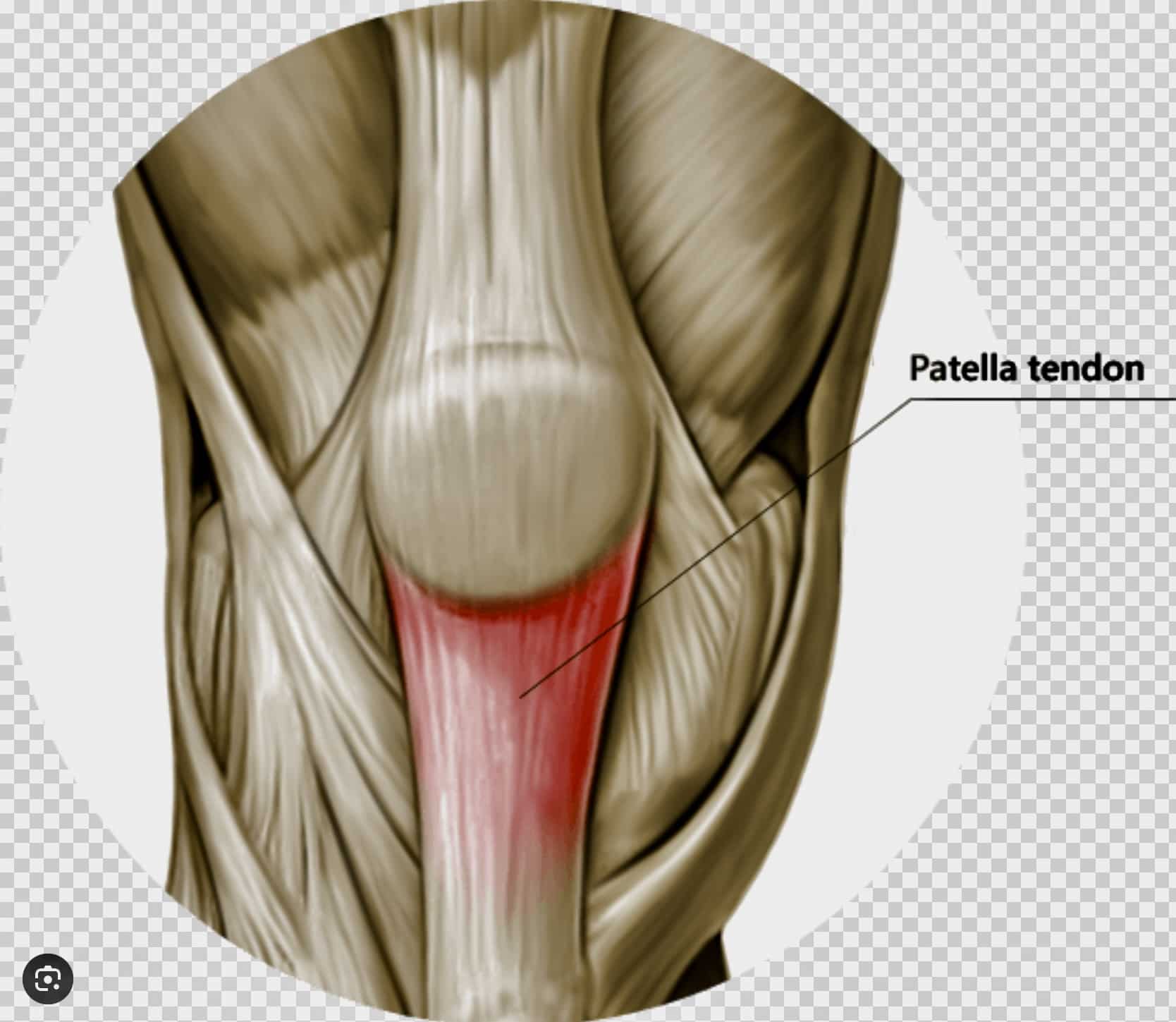 Jumper’s Knee a.k.a. Patellar Tendinopathy - Chiromovement | Muscle and Joint Clinic
